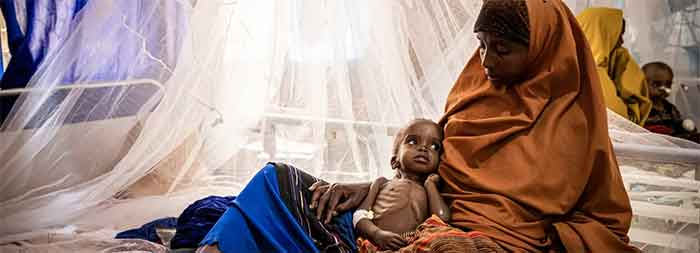 Somalia’s Long Journey from Prosperity to Hunger Deaths – Eurasia